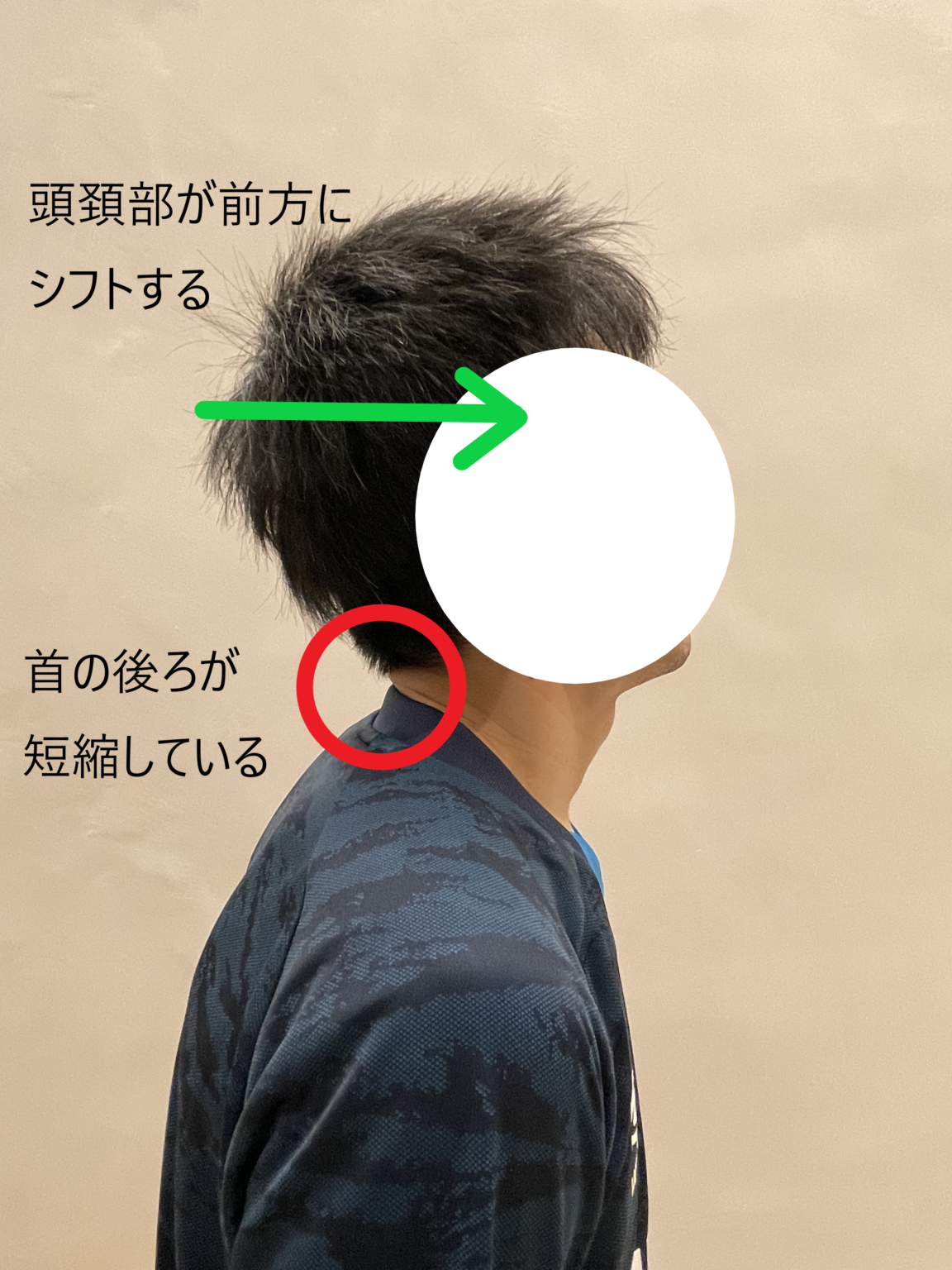 【頭が前にでている人必見】フォワードヘッド改善エクササイズのポイントについて。